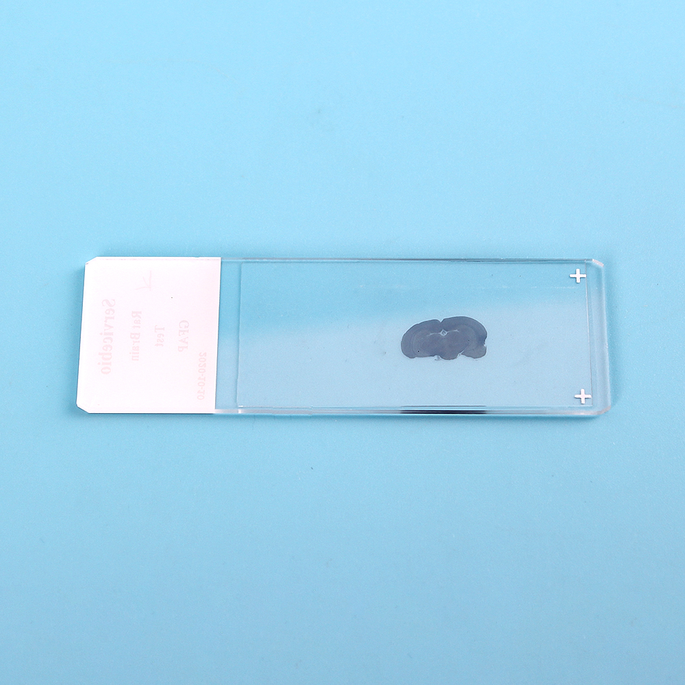 Adhesion Microscope Slide for Paraffin Section Sterile And Enzyme Free ...